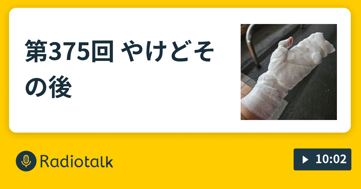 第375回 やけどその後 - ラージ・ストーンのチャレンジradio - Radiotalk(ラジオトーク)
